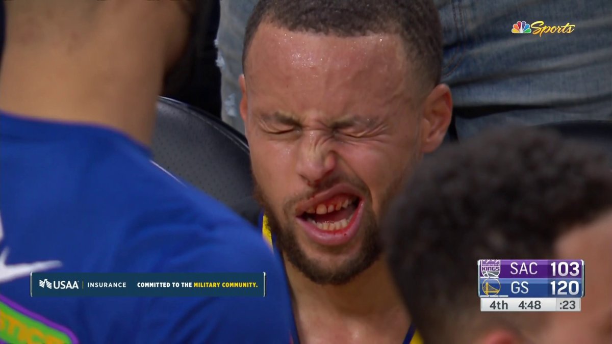 Steph Curry gets bloody nose after taking hit to face from Buddy Hield ...
